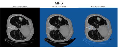 Segmentation Error On Mps Device · Issue 458 · Facebookresearchsegment Anything · Github