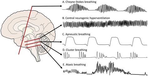 Breathing And The Nervous System Clinical Tree