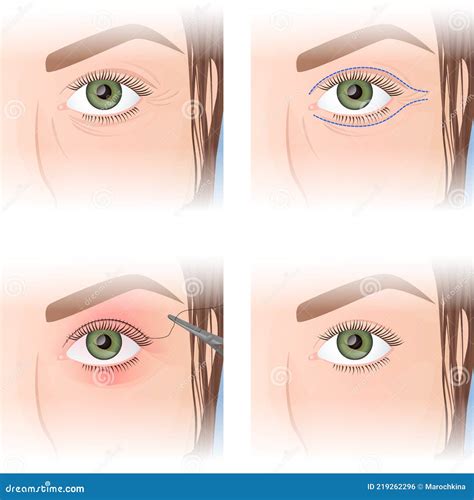 Postoperative Period Vector Line Icon Linear Concept Outline Sign Symbol