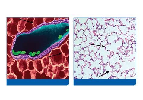Simple Squamous Epithelium Diagram Quizlet