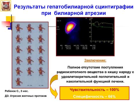 Пороки развития и заболевания желчных протоков и желчного пузыря у детей презентация онлайн
