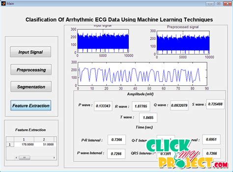 clasification of arrhythmic ecg data using machine learning techniques