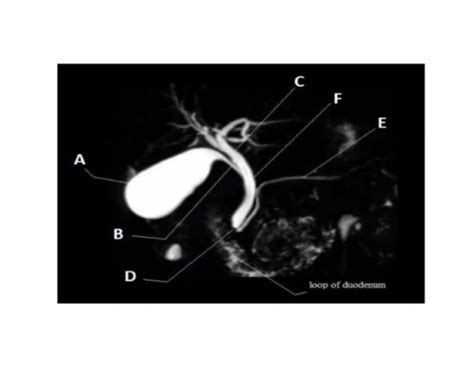 Loop Of Duodenum Quiz
