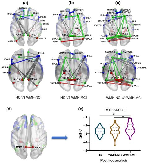 Post Hoc Analyses In Group Differences Of Staticdynamic Fc At Roi Download Scientific Diagram