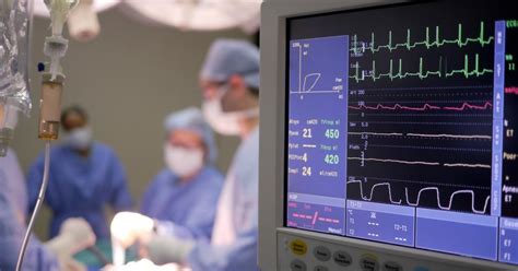 What Are The Triggers Of Atrial Fibrillation