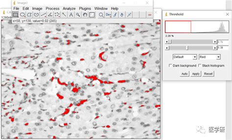 Imagej得到灰度图数据 轻松学会用image J定量分析免疫组化图 瑾欢的博客 Csdn博客