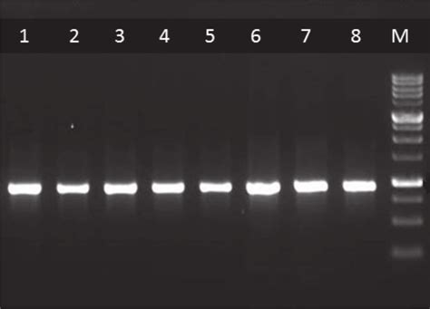 Colony Pcr Of The Transformed Destination Vector Colonies In Bl21 Host