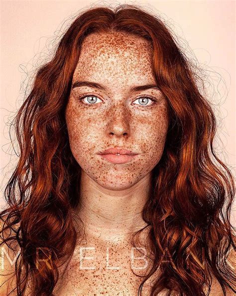 Freckles Beautiful Freckles People With Freckles Freckles Girl