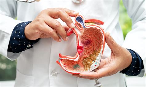 What You Need To Know About Stomach Cancer Symptoms Risk Factors