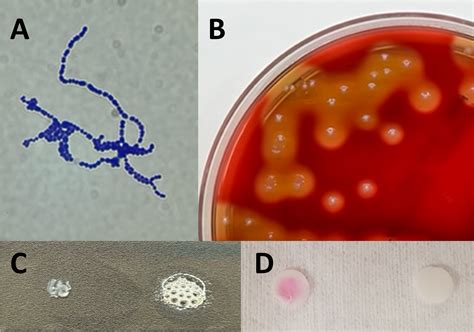 Microbiology Case A 35 Year Old Male With Left Leg Cellulitis