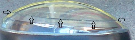 protection kit from firebugman tdiclub forums