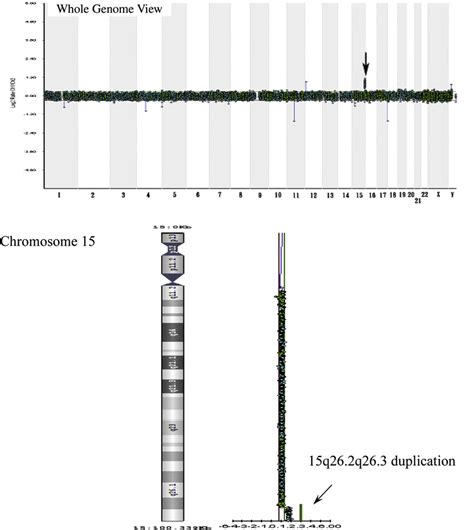 Oligonucleotide Based Array Comparative Genomic Hybridization Shows A Download Scientific