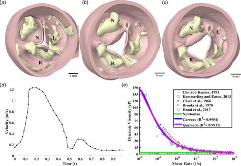 Cfd Model Preparation A Diastolic Configuration With A Tri Leaflet Download Scientific