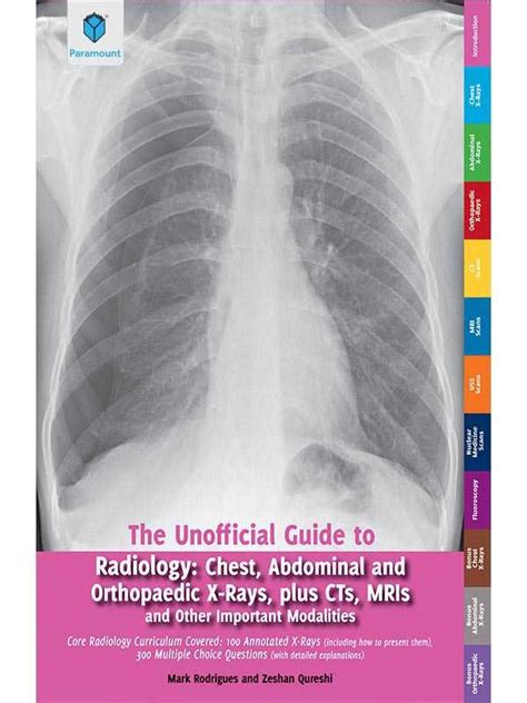 The Unofficial Guide To Radiology Chest Abdominal And Orthopaedic X Rays Plus Cts Mris And