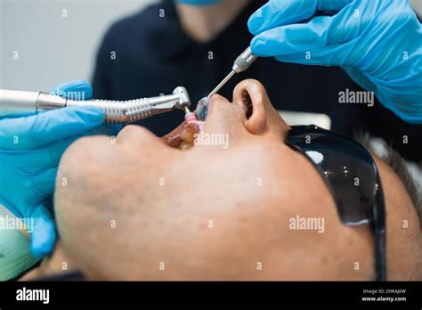 Dentist Doing Teeth Cleaning Procedure For Male Patient Professional