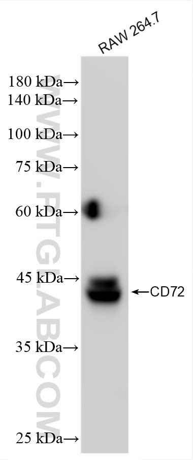 Cd72 Antibody 85208 5 Pbs Proteintech