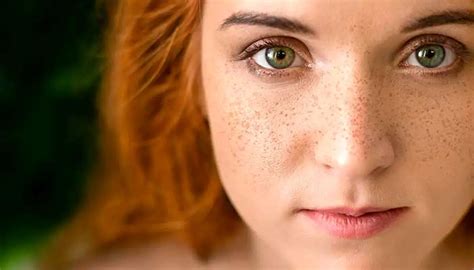 اگر کک و مک دارید بخوانید از پوستی که کک و مک دارد باید اینگونه مراقبت