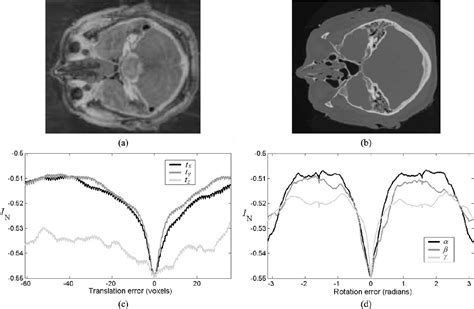 figure 2 from an approach to multimodal biomedical image registration