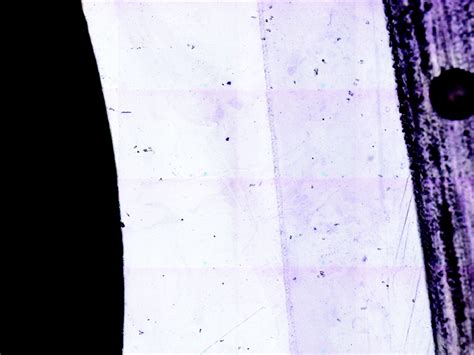 Bone Reaction To A Biomimetic Third Generation Hydroxyapatite Coating