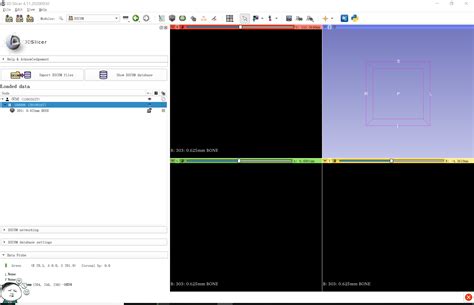 Dicom格式导入不显示，黑屏怎么办呢？ 问题求助 3dslicer中文论坛