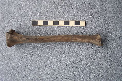 Pdf Partney By Pass 18