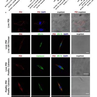Figure Supplement 2 Antibody Red And The Nuclear Marker DAPI Blue Download Scientific