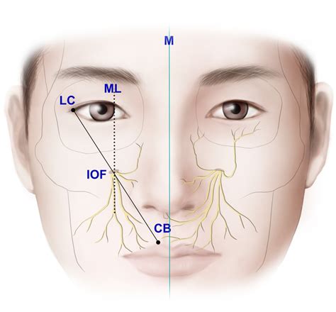 Infraorbital Foramen Store Website Brunofugaadvbr Infraorbital Foramen Store Website Brunofugaadvbr