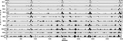 Figure 1 From Cross Subject Myocardial Infarction Detection From