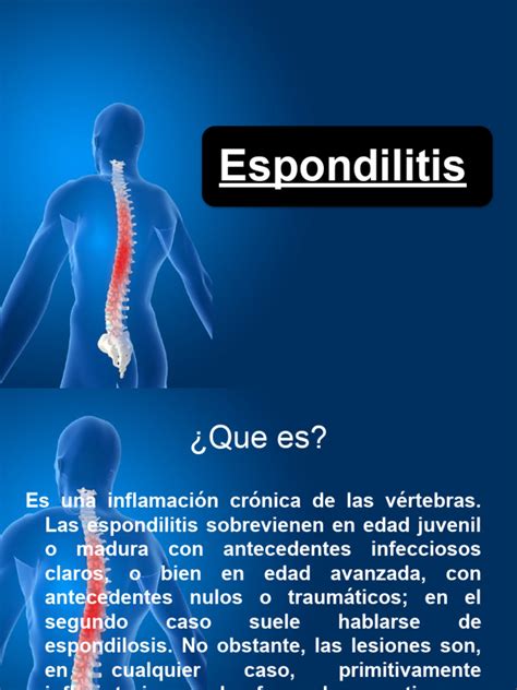 Espondilitis Pdf Medicina Enfermedades Y Trastornos Humanos