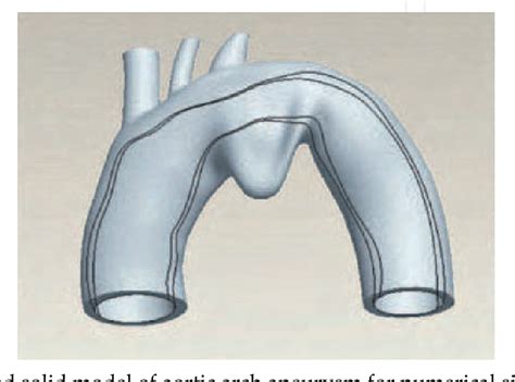Figure 4 From Numerical Simulation In Aortic Arch Aneurysm Semantic Scholar
