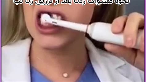 مسواک زدن بعد از تزریق ژل لب نماشا