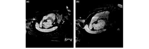 Two Examples Quantified By The Blindreferenceless Image Spatial Download Scientific Diagram