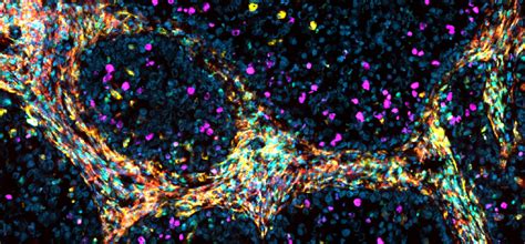 Publications — Johanna Joyce Lab