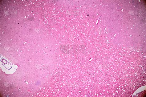 实验用显微镜下小脑和神经人体横切面。