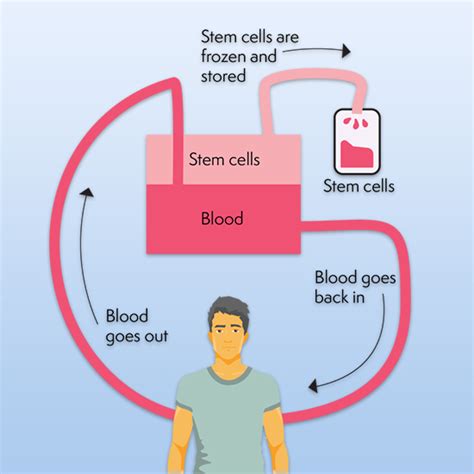 Autologous Stem Cells In India Stem Cell Care India