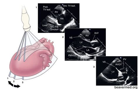 Dr Sumiya Зүрх судасны эмч Зүрхний митрал буюу хоёр хавтаст хавхлага гэж юу вэ Зүүн