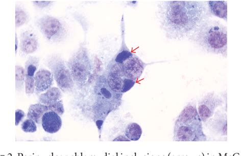 Figure 2 From Identification And Characterization Of Chlamydia Abortus Isolates From Yaks In