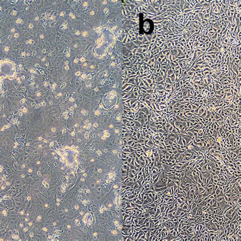 Photos Taken From An Inverted Microscope Show The Cpv Growth In The