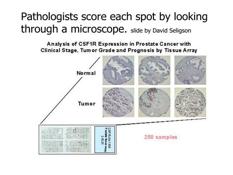 Ppt Tree Based Methods For Analyzing Tissue Microarray Data
