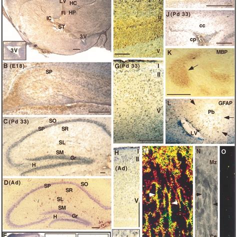 Agenesis Of The Corpus Callosum In L Minus Mice Download Table