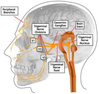 Trigeminal Nerve Block