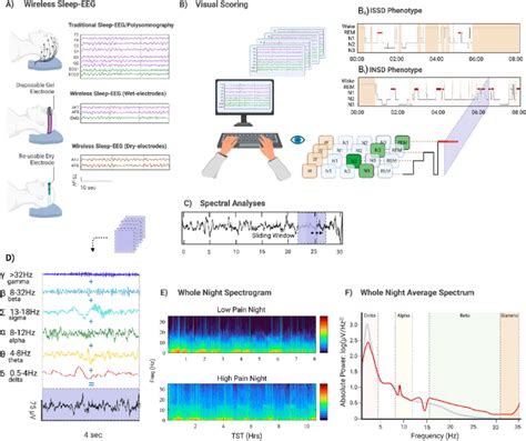 Summary Of Sleep Eeg Techniques A Visualization Of The Most Common
