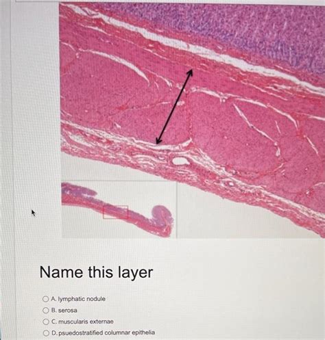 Solved Name This Layer A Lymphatic Nodule B Serosa C Solved Name This Layer A Lymphatic Nodule B Serosa C