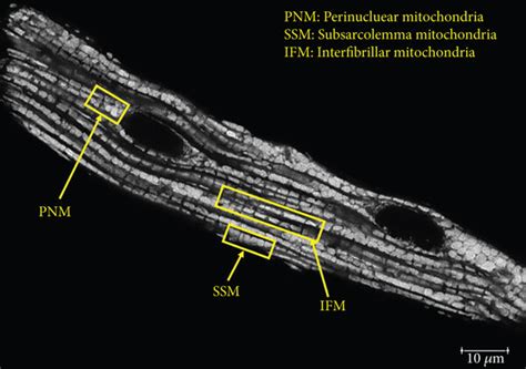 Subpopulations Of Mitochondria In The Isolated Primary Adult Download Scientific Diagram