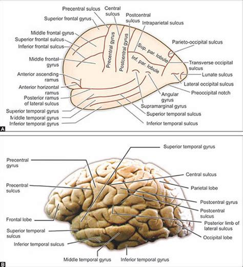 Transverse Temporal Sulcus