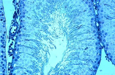 Rat Testis Light Micrograph Stock Image C0611693 Science Photo