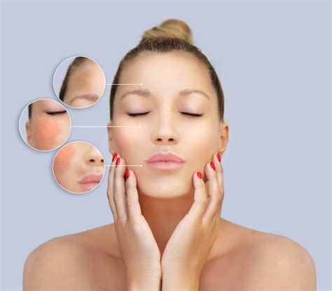 Pigment Dissolve What You Need To Know