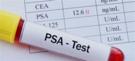 전립선암 로봇수술비용과 수술후 Psa수치