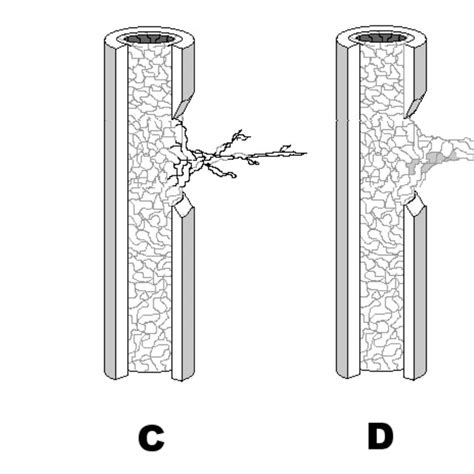 Diagrammatic Description Of The Steps Involved In Angiogenesis A A