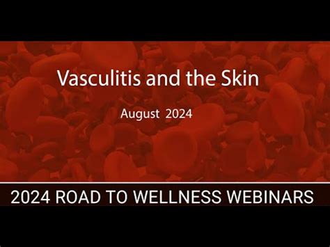 Cutaneous Small Vessel Vasculitis Vasculitis Foundation